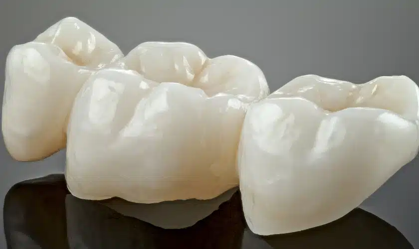 The Benefits Of Porcelain Crowns: An Overview