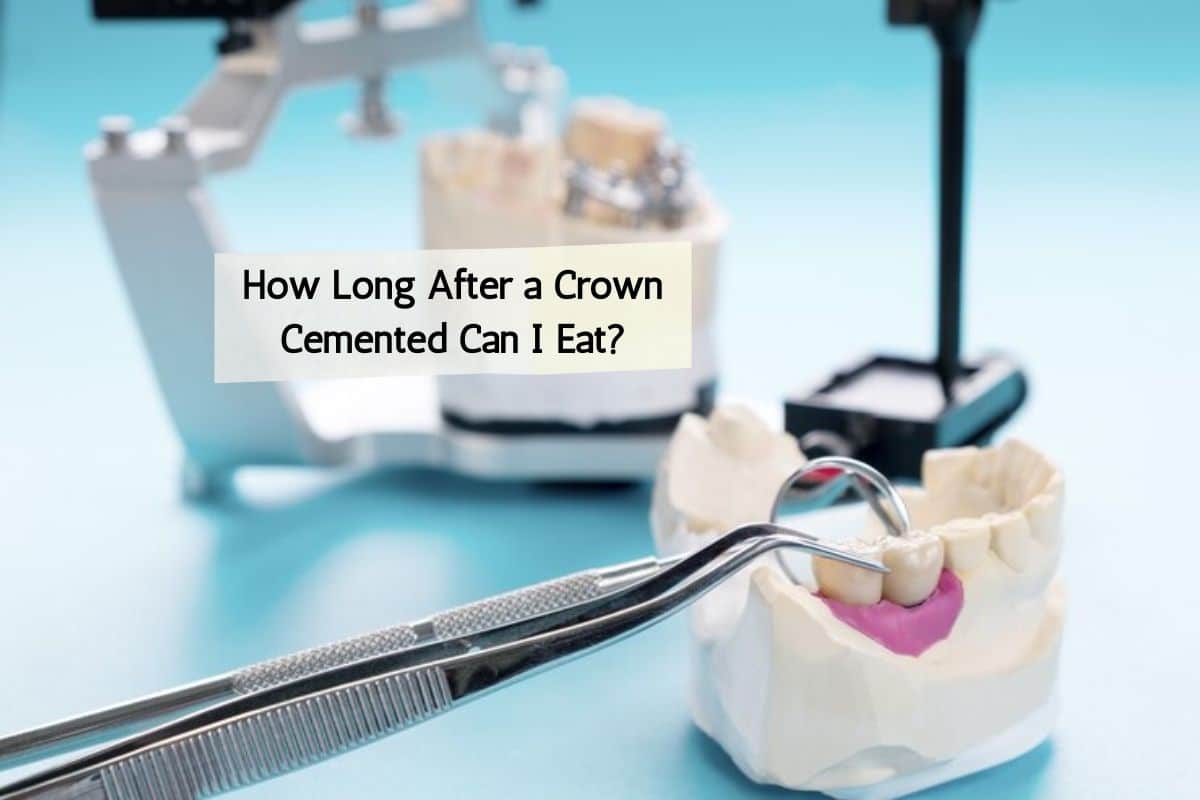 How Long After a Crown Cemented Can I Eat?