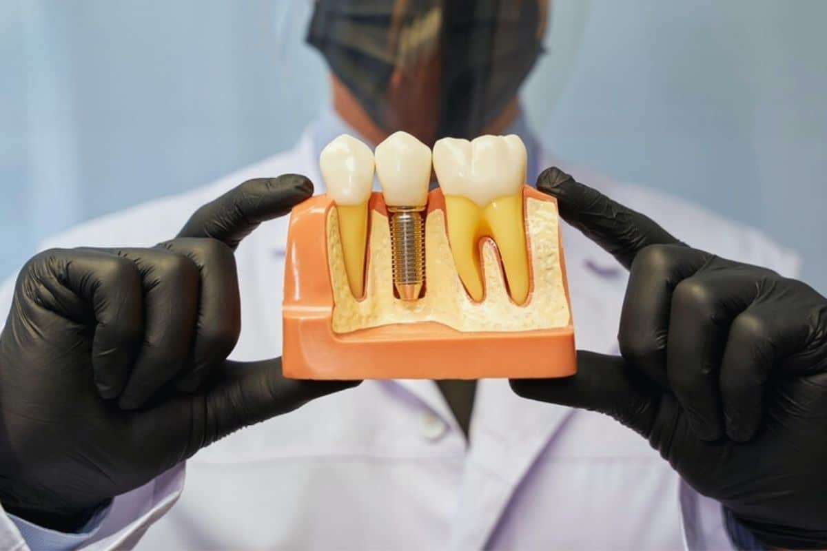 How Long After a Crown Cemented Can I Eat?